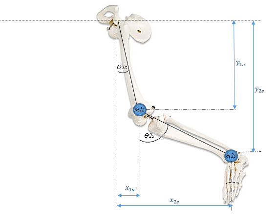 Modeling amputee gait: analogy of the triple inverted pendulum ...